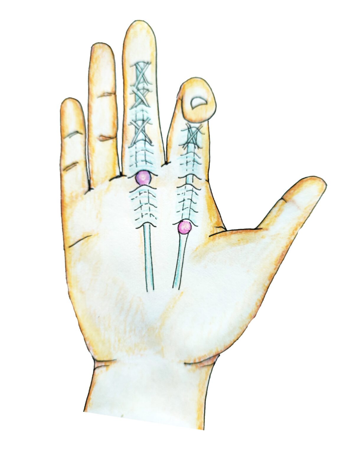 Trigger Finger | Medentis Manus | Beograd - Srbija